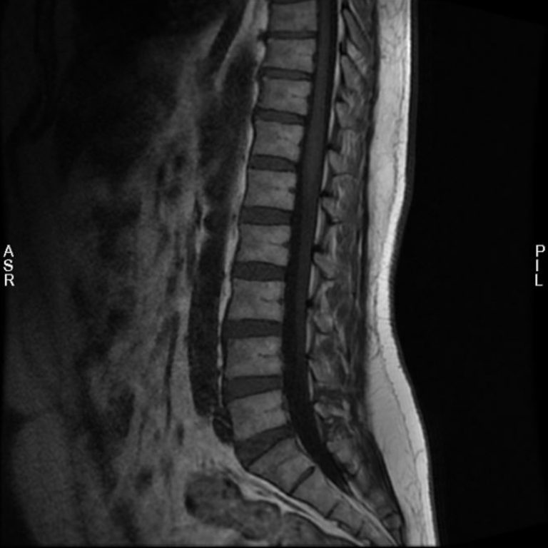 irm-2 | Centre d'imagerie médicale provence