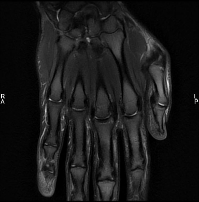 irm-3 | Centre d'imagerie médicale provence