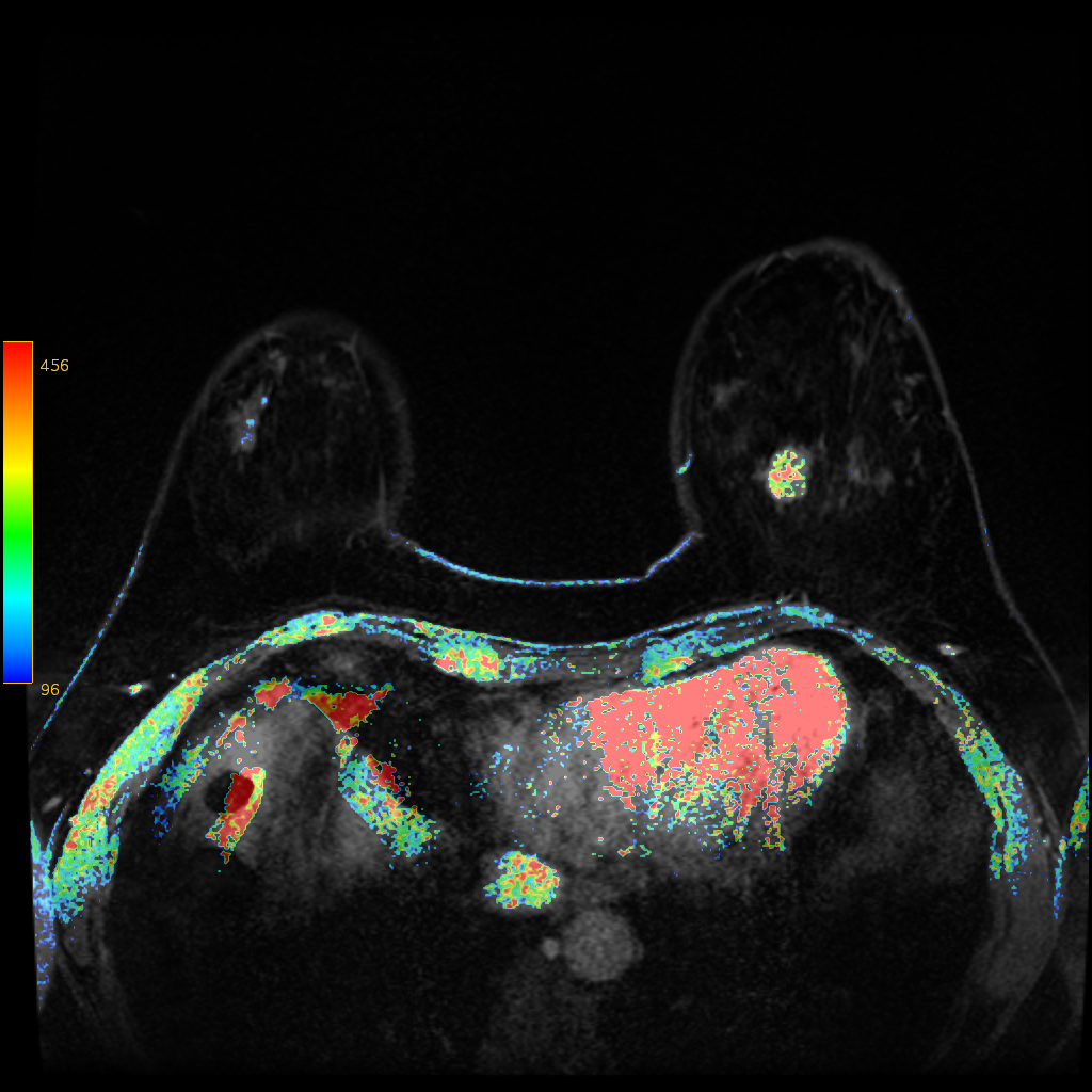 IRM | Centre d'imagerie médicale provence