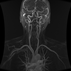 angio irm carotides | Centre d'imagerie médicale provence