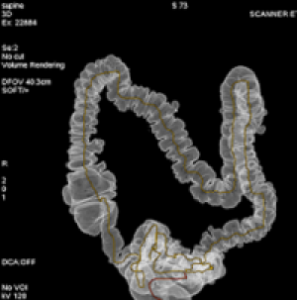 Scanner | Centre d'imagerie médicale provence