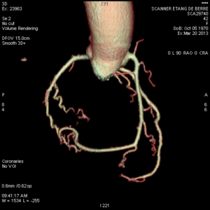 Scanner | Centre d'imagerie médicale provence